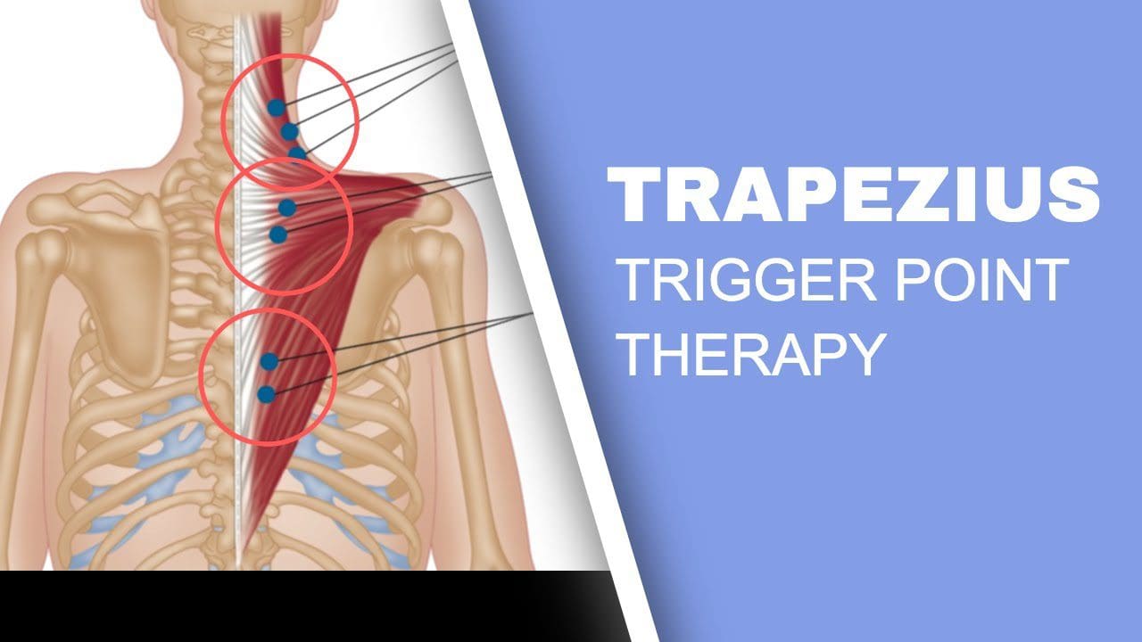 Trapezius And Neck Pain