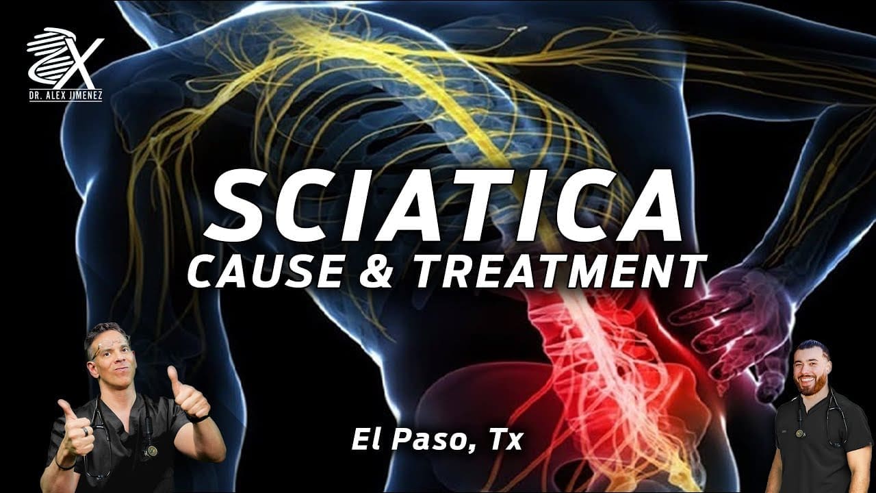 *SCIATICA* Causes & Treatments | El Paso, Tx (2023) - El Paso, TX | Sciatica Pain and Treatment ...